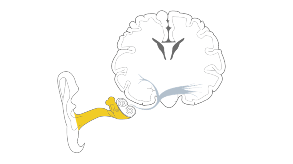The 3 Types of Hearing Loss: Conductive, Sensorineural and Mixed