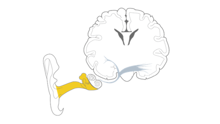 The 3 Types of Hearing Loss: Conductive, Sensorineural and Mixed